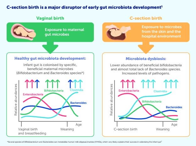 C-Section Birth and the Infant Gut Microbiota: Nutritional Strategies